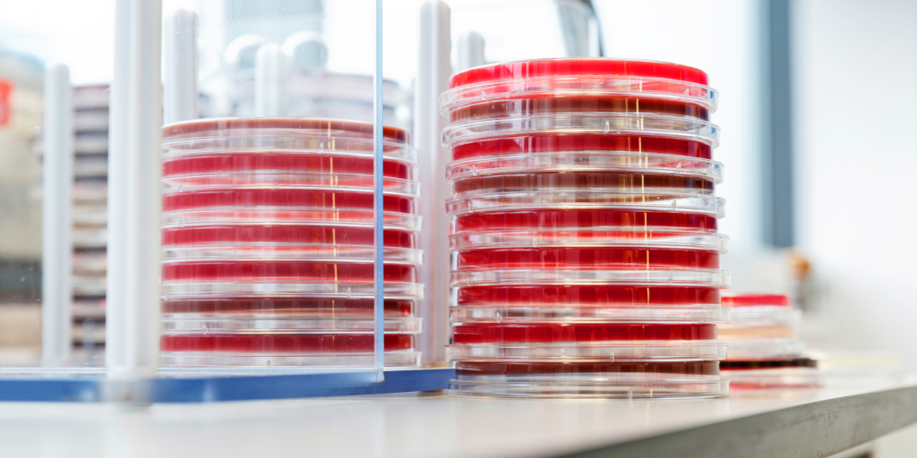 SMITH | Universitätsklinikum RWTH Aachen beginnt Interventionsphase im ...